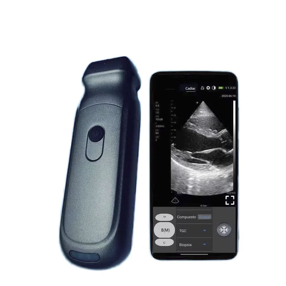 Hand-held ultrasound system - FTL-S9PA - Fatali Medical - for ...