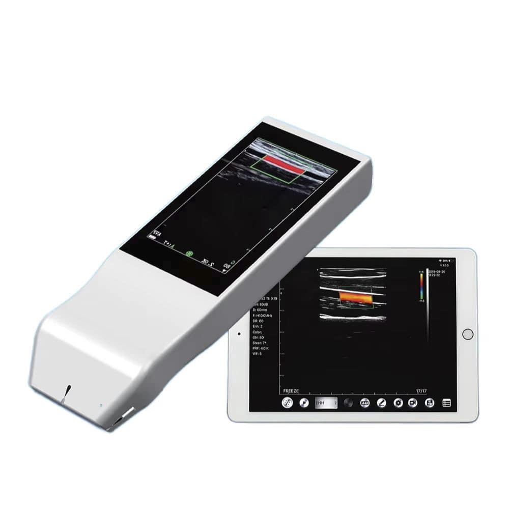 Hand-held ultrasound system - FTL-V5L - Fatali Medical - for ...