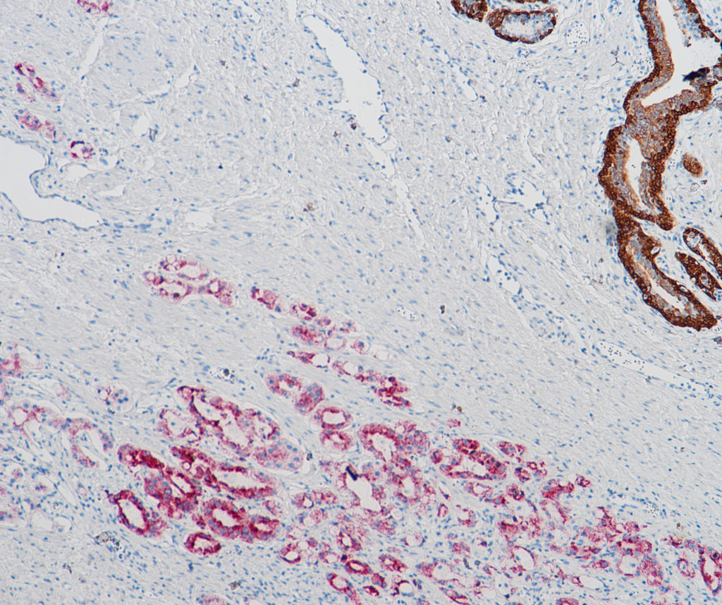 Staining solution reagent kit - SD8009 - Celnovte Biotechnology Co ...