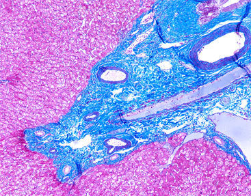 Stain reagent kit - Celnovte Biotechnology Co., Ltd. - for histology