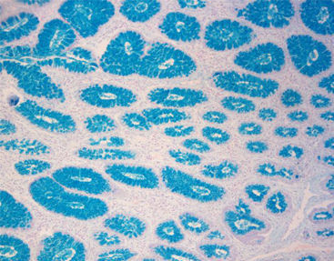 Stain reagent kit - Celnovte Biotechnology Co., Ltd. - dye / for ...