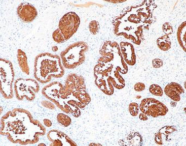 Staining solution reagent - CPR-0221 - Celnovte Biotechnology Co., Ltd ...