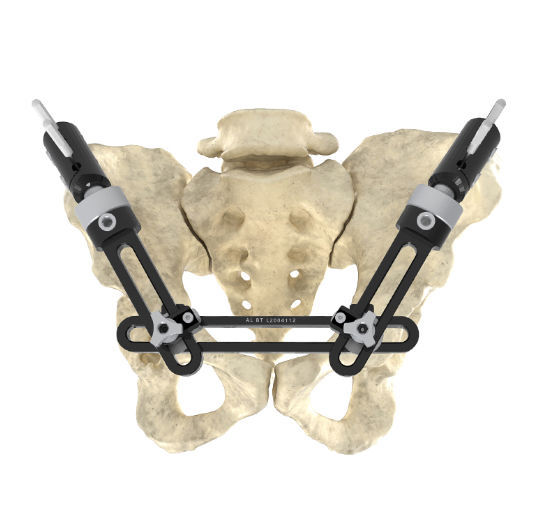 Pelvis external fixation system - Wuxi Betta Medical Technology ...