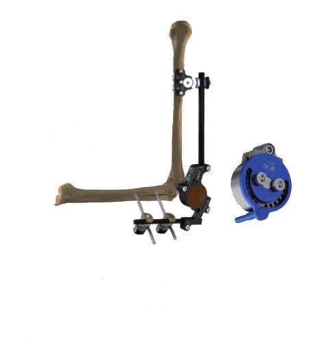 Elbow external fixation system - Wuxi Betta Medical Technology - hybrid ...