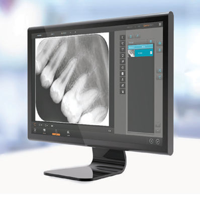 Dental imaging software - QuantorDent - Digiray - image analysis ...
