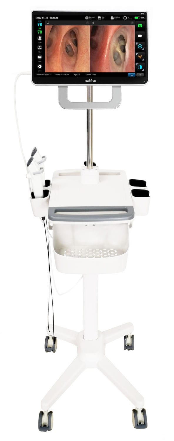 Surgical trolley - Endoso Life Technology - endoscopy / 1-drawer / 2-tray