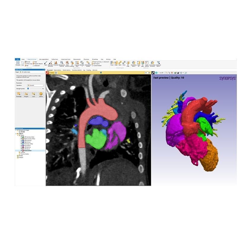 Medical imaging software - Simpleware - Synopsys Simpleware Product Group - diagnostic ...