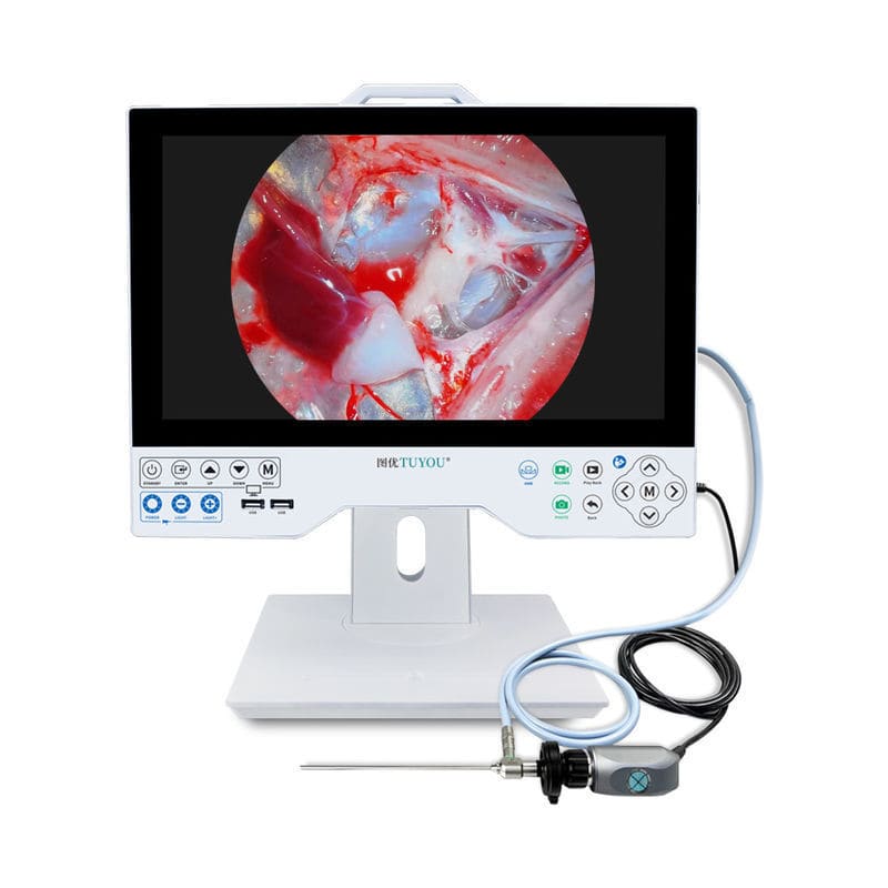 Endoscope camera - TU-15LSD101B - Shenzhen Tuyou Medical Imaging Co ...