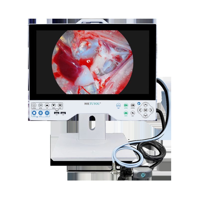 Endoscope camera - TU-15LSD series - Shenzhen Tuyou Medical Imaging Co ...