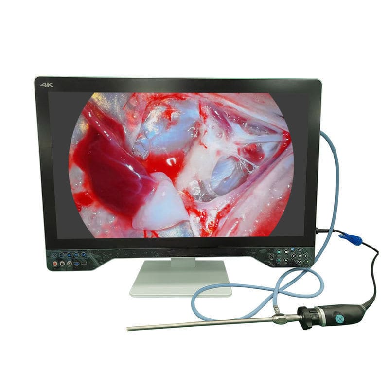 Endoscope camera - TU-32LSD1A - Shenzhen Tuyou Medical Imaging Co., Ltd ...