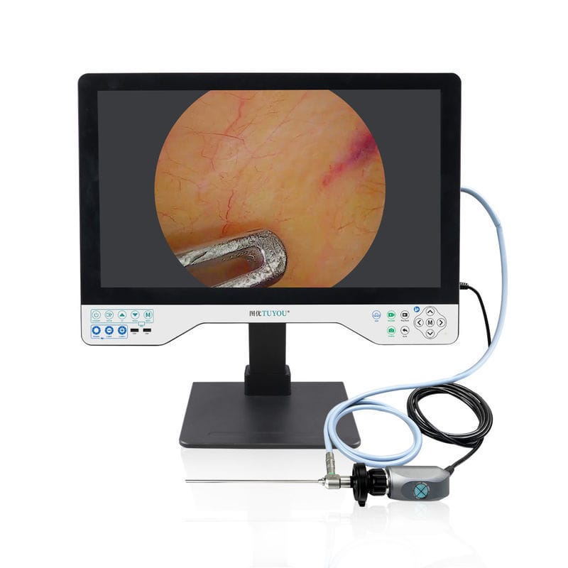 Endoscope camera - Shenzhen Tuyou Medical Imaging Co., Ltd. - medical ...