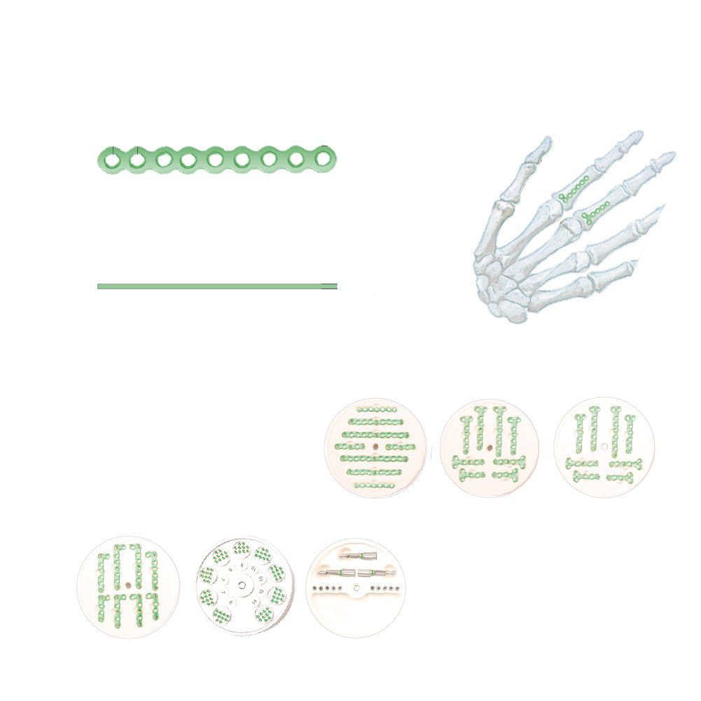 Hand phalange compression plate - TML - Kangli Medical - distal ...