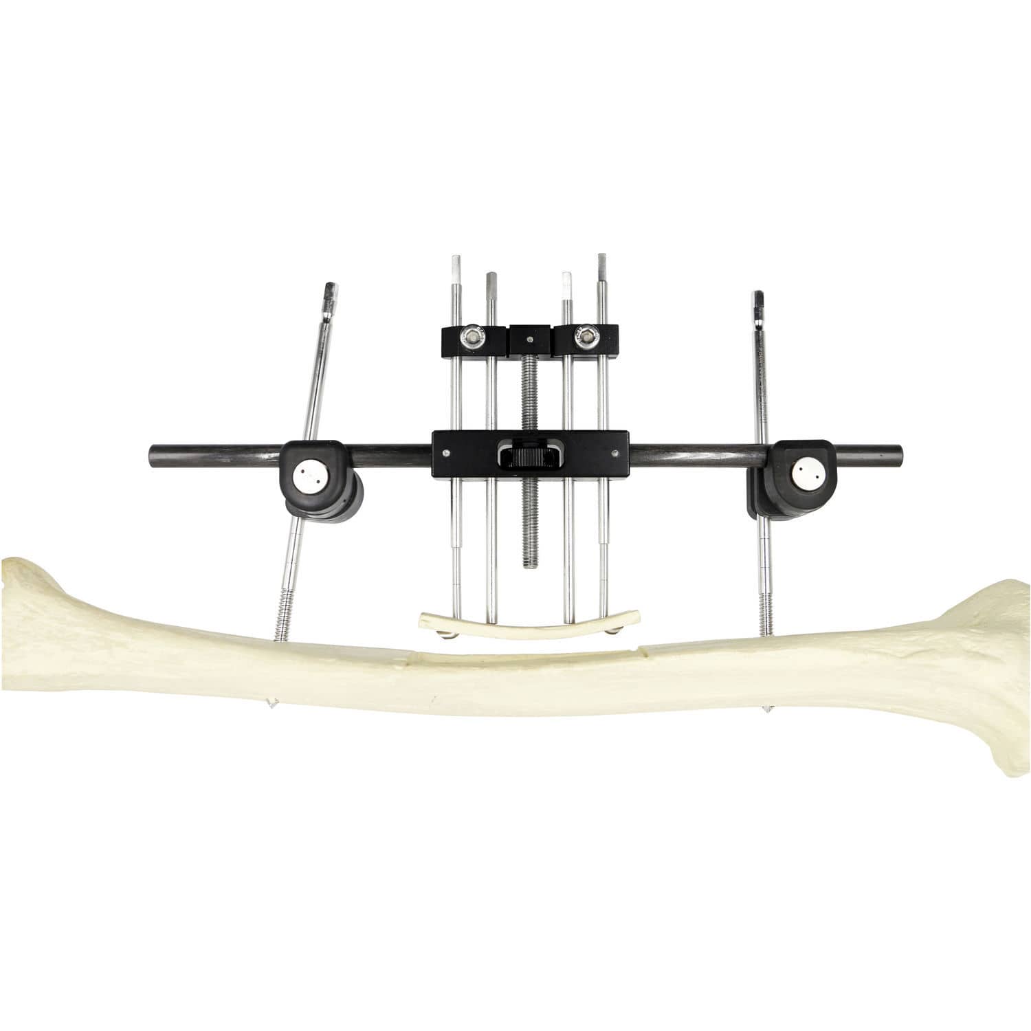 Femur external fixation system - Chongqing FWS Medical Devices ...