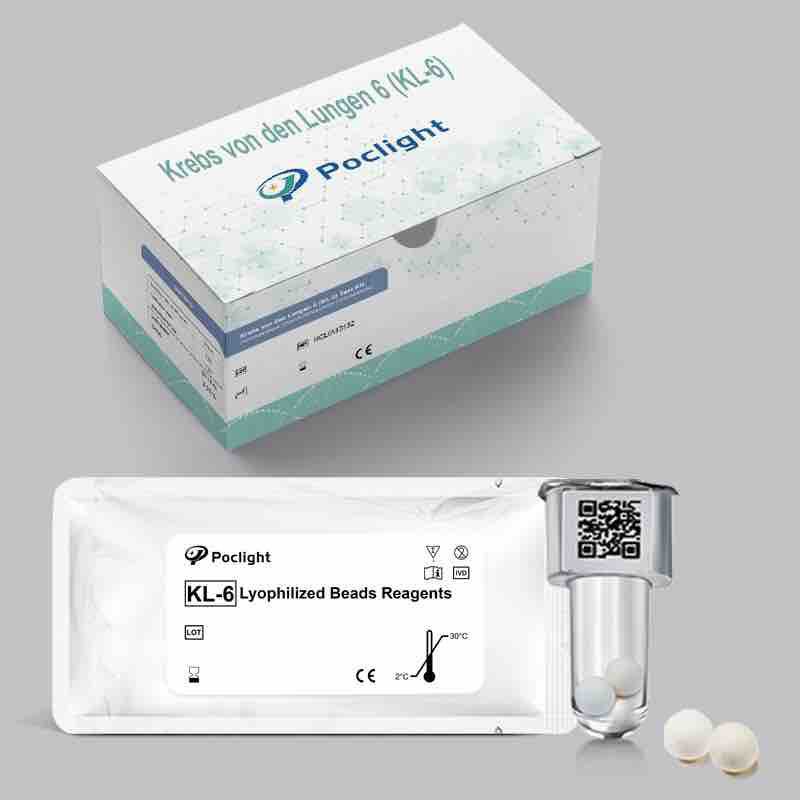 Lung cancer test kit - KL-6 - Poclight - serum / plasma ...