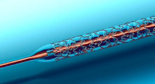 Coronary stent - I-SYNC - Purple Microport - polymer