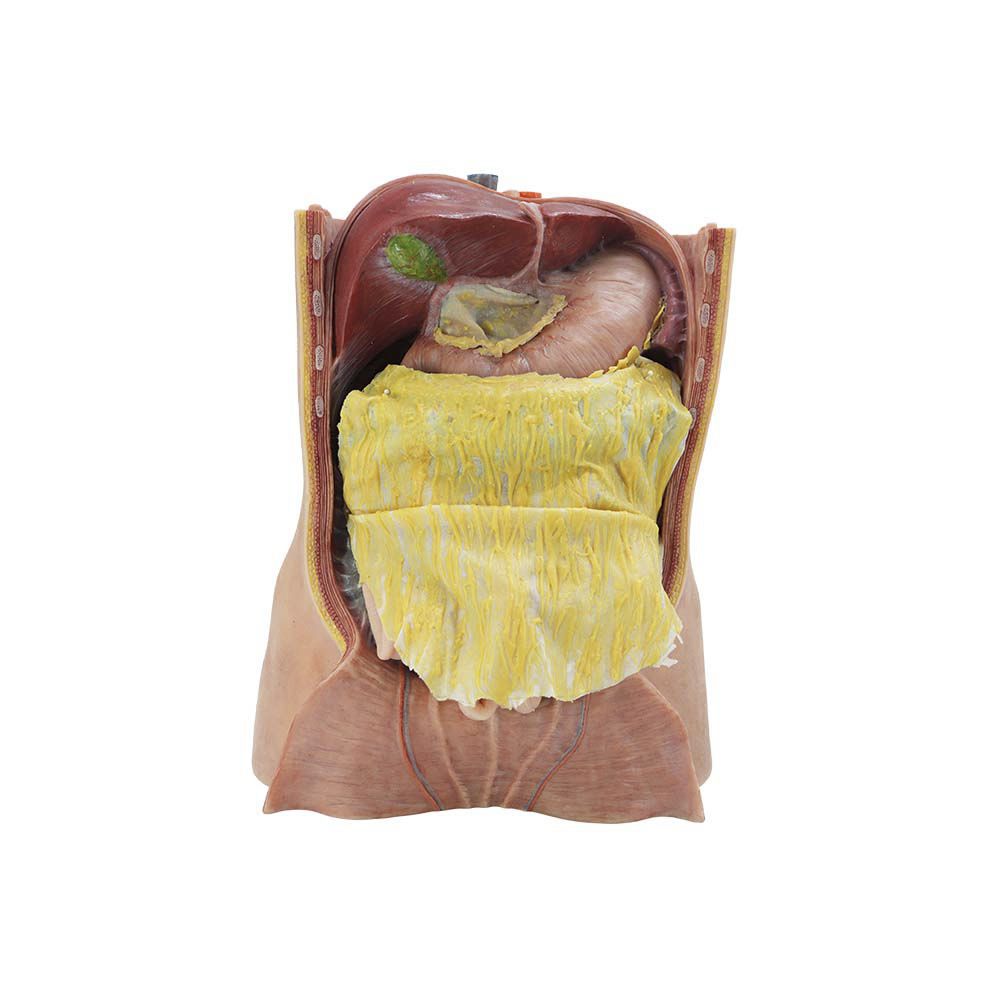Abdominal model - MeiWo Science - celiac trunk / for teaching / silicone