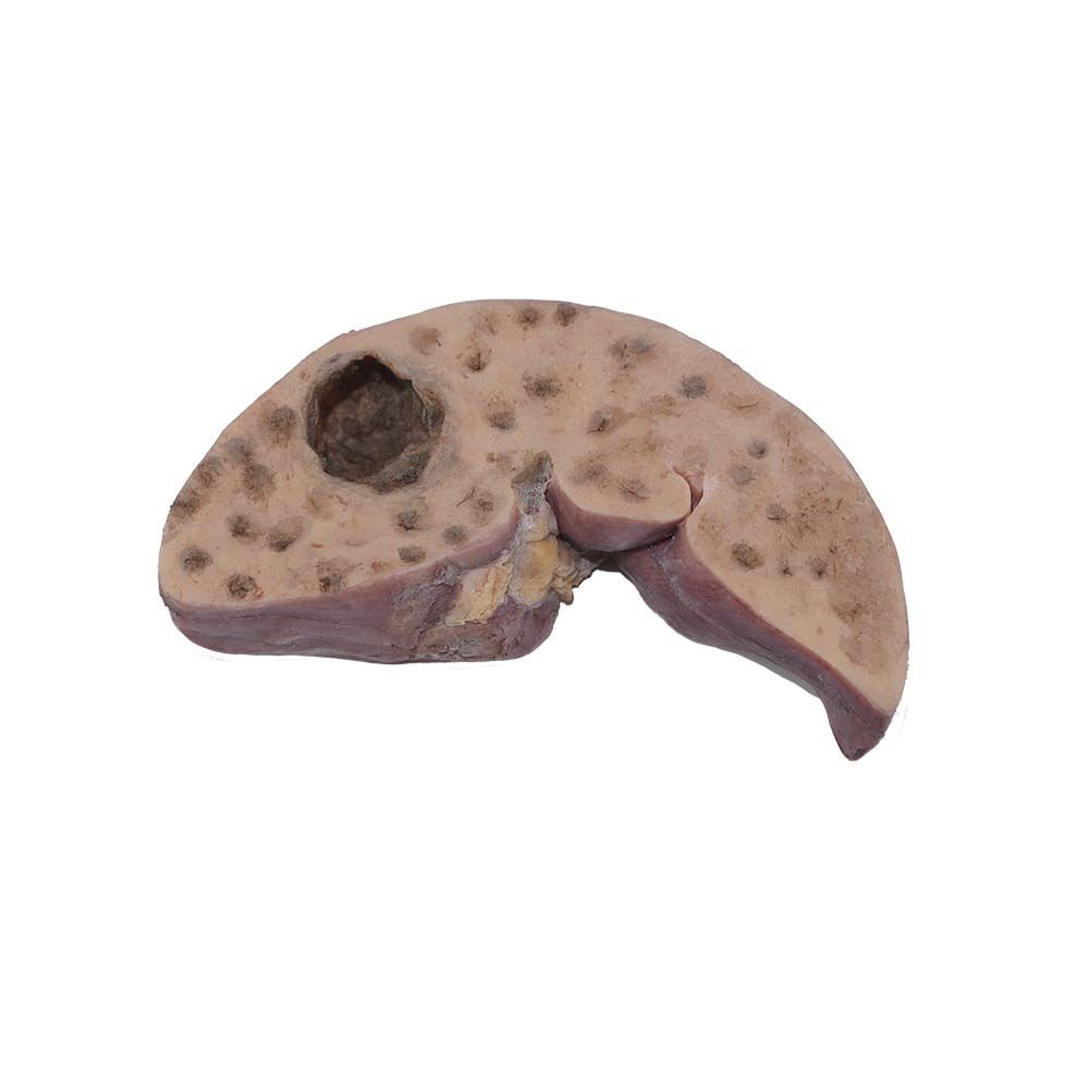 Liver anatomical model - PX-002 - MeiWo Science - for health education ...