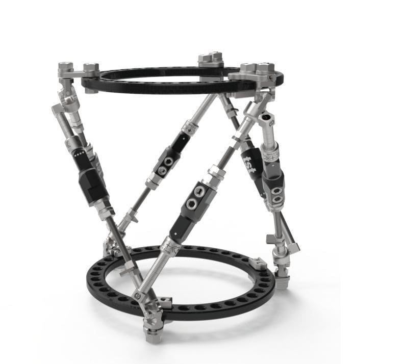 Tibia external fixation system - Ortho-SUV - TST Othopedics - circular ...