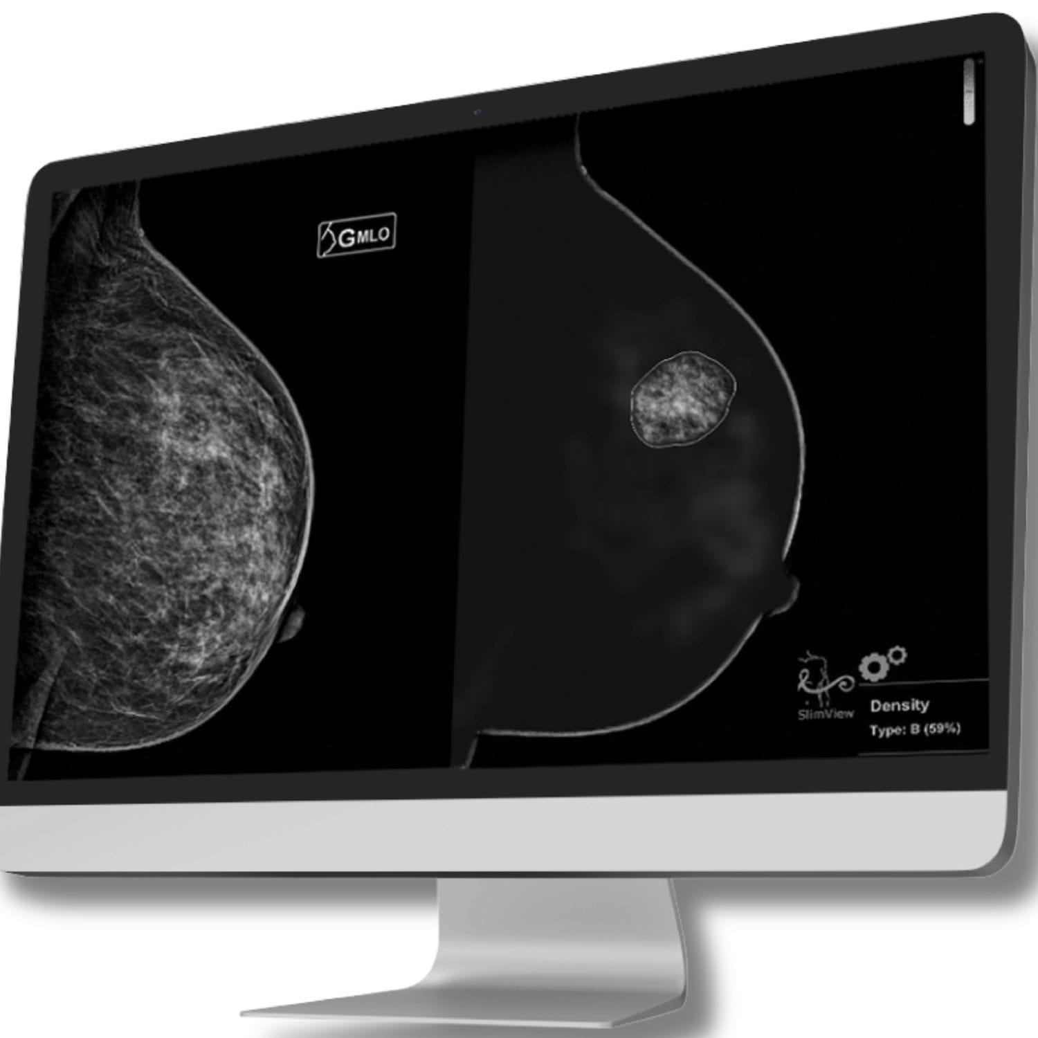 Breast tomosynthesis medical software - Breast-SlimView® - Hera-MI ...