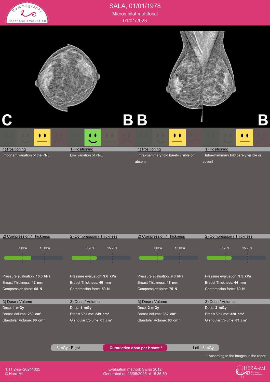 Analysis medical software - MTE - Hera-MI - medical / for mammography ...