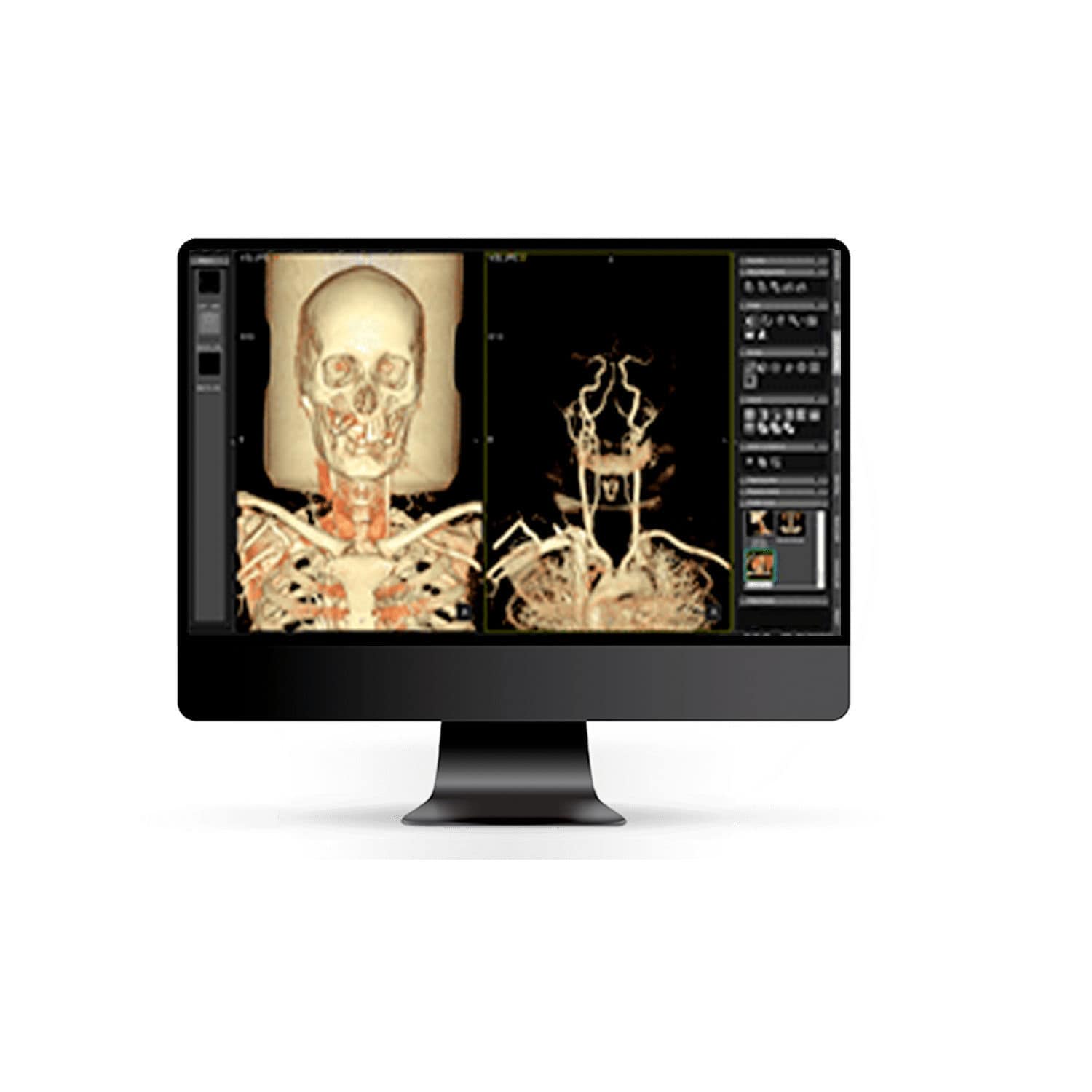 DICOM viewer - FireVIEW 2D - Firethunder