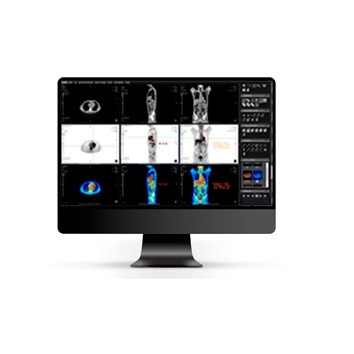 DICOM viewer - FireVIEW NUCLEAR - Firethunder