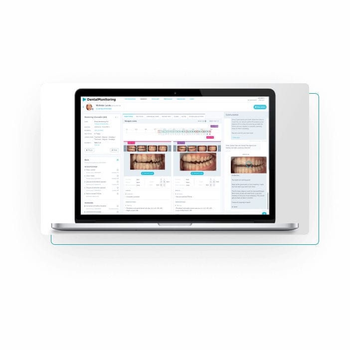 Dental AI platform - Dental Monitoring - image analysis / treatment / scan