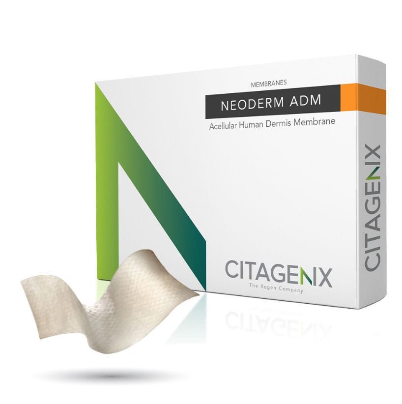 Dental restoration dental matrix - Neoderm™ ADM - Citagenix