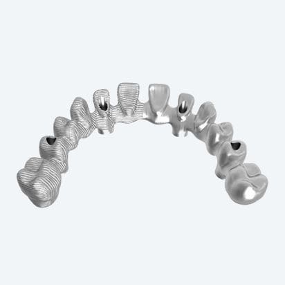 Titanium dental bridge - NEW ANCORVIS S.r.l - posterior teeth