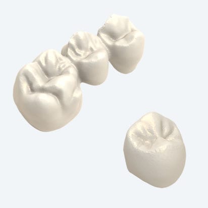 PMMA dental prosthesis - NEW ANCORVIS S.r.l - composite / zirconia / CoCr