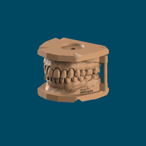 Gingival anatomy model - NEW ANCORVIS S.r.l - dental / resin