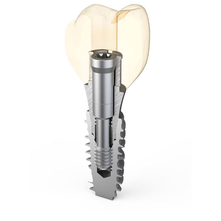 Titanium implant abutment - Master Fix - ARUM DENTISTRY Co., Ltd ...