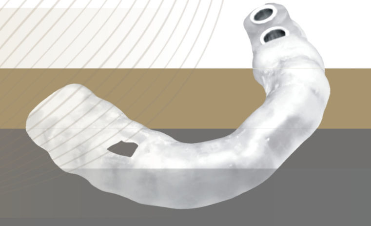 Dental implantology surgical guide - Alliance Global Technology Co.,Ltd