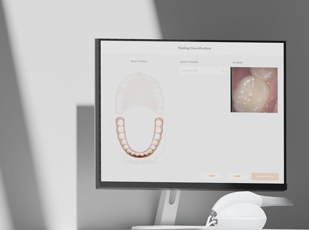 Treatment software - Scan&Tell - 3DISC DENTAL CONNECT - scan / medical ...