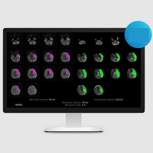 Image analysis software - MRI - RapidAI - scan / medical / clinical