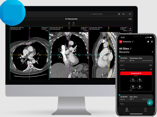 Medical software - PE - RapidAI - clinical / viewer / diagnostic