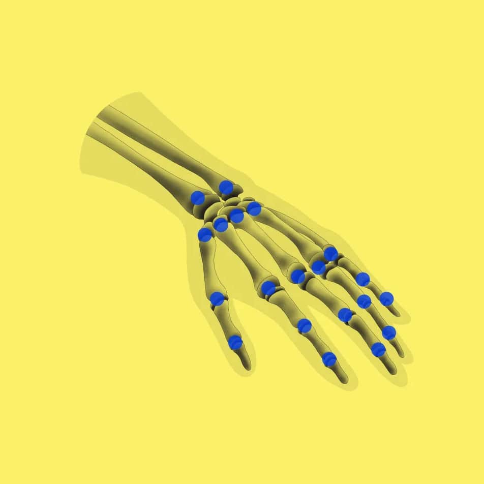 Medical software - BoneAge - Gleamer - clinical / pediatric / bone