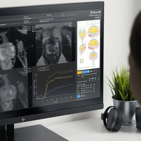 Image analysis software - QUANTIB® - Quantib B.V. - evaluation ...