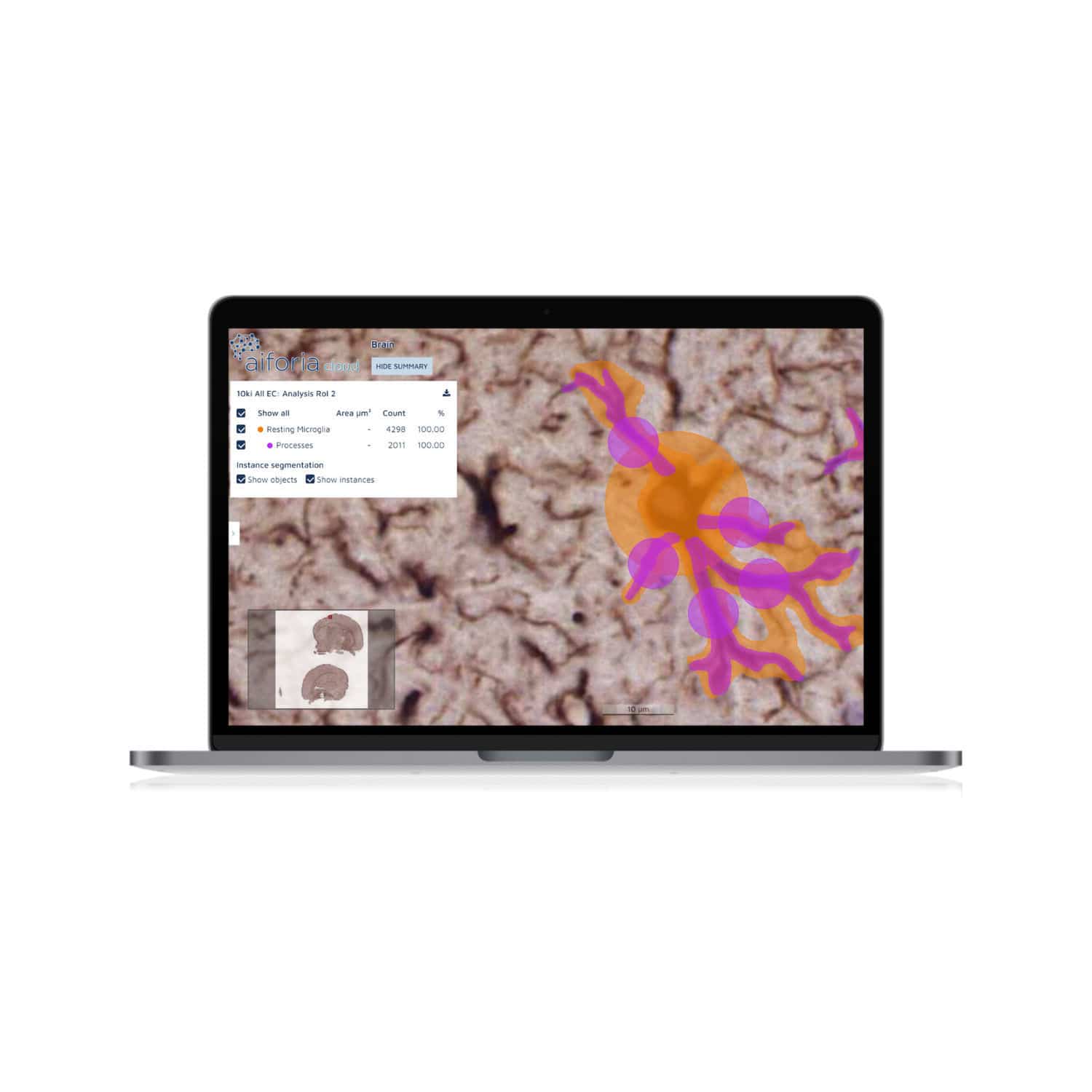 AI-based software - Aiforia Create - Aiforia Technologies - image ... AI-based software - Aiforia Create - Aiforia Technologies - image ...
