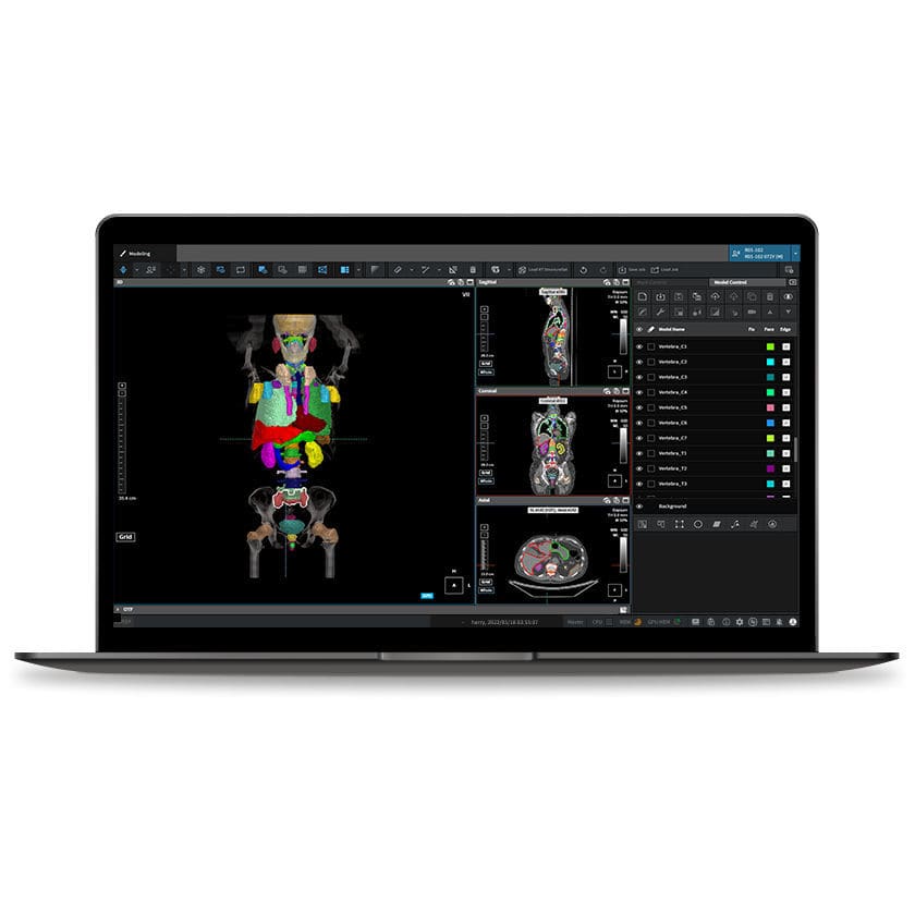 Treatment planning software - RT ACS - Coreline - treatment ...