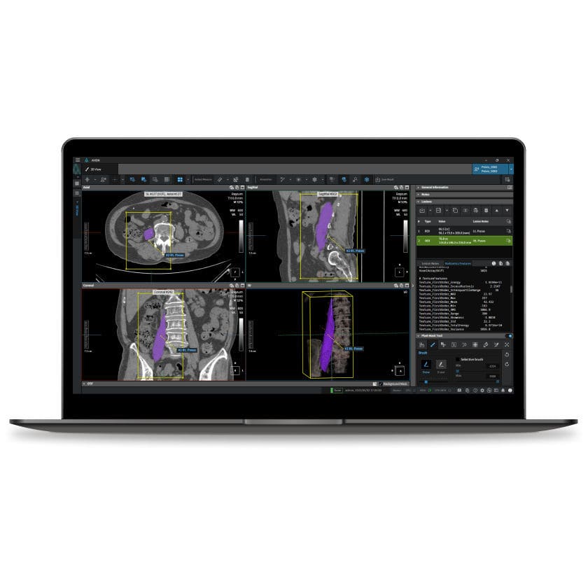 Data management software - Coreline - medical / for research / 3D