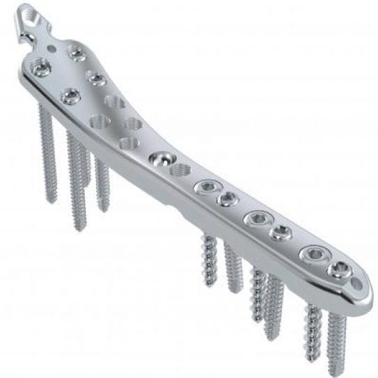 Tibia compression plate - 5712-009 series - Ortobio - distal / locking ...