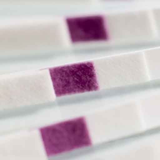 Kidney disease test strip - GBR-3409 - Golden BioTechnologies - AMP ...