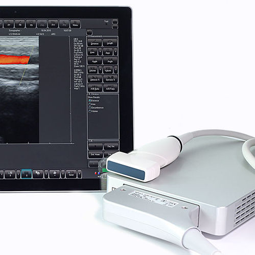 On-platform, tabletop ultrasound system - ArtUs - TELEMED - for ...