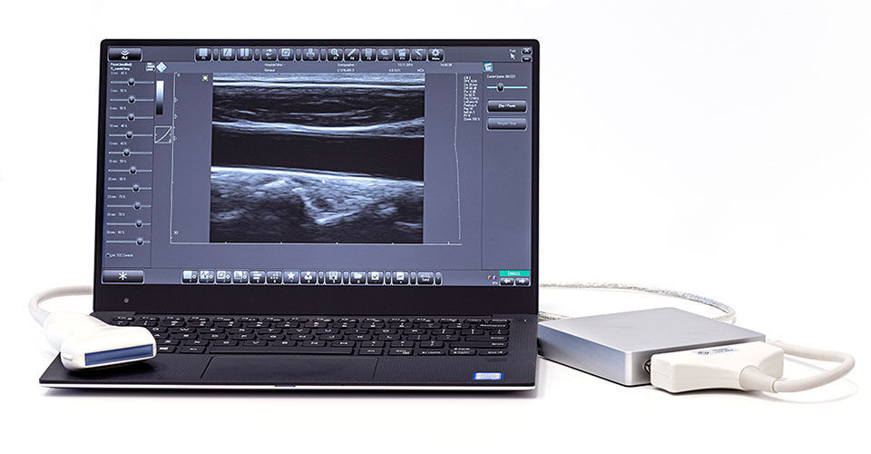 On-platform, tabletop ultrasound system - MicrUs - TELEMED - for ...