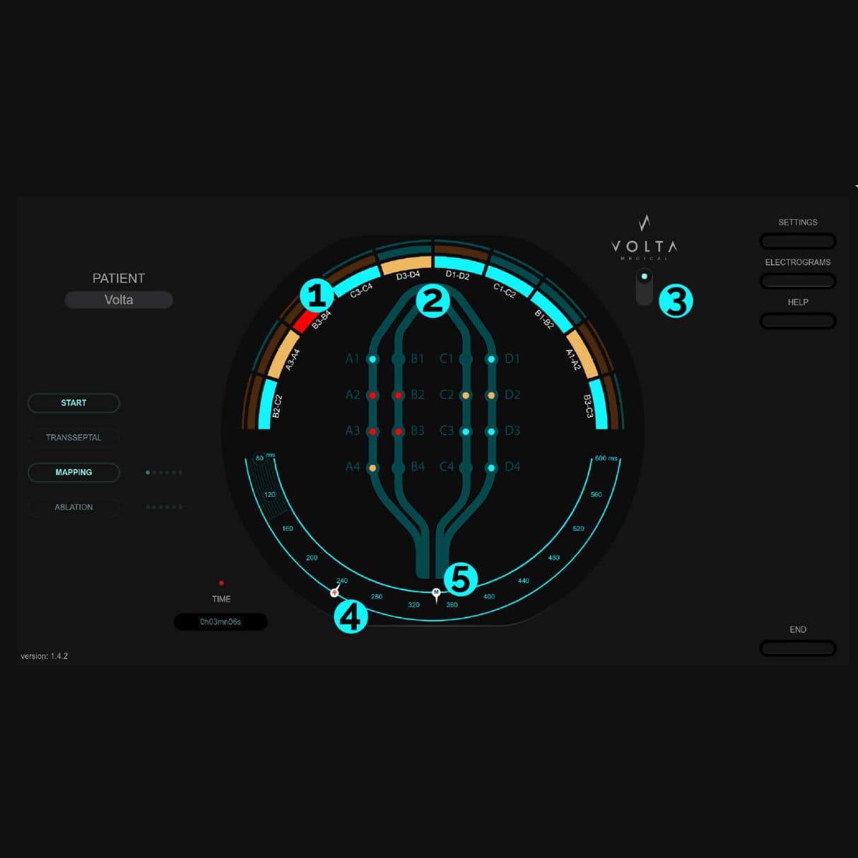 Machine learning software - VX1 - Volta Medical - medical / for cardiac ...