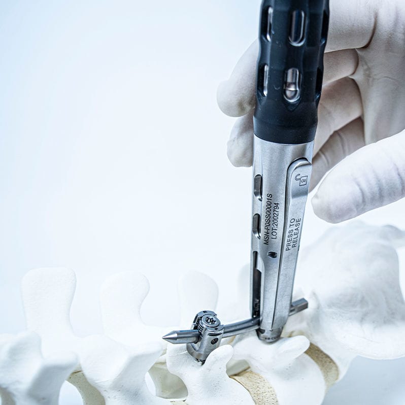 Thoraco-lumbo-sacral osteosynthesis unit - Misano - Next - posterior ...