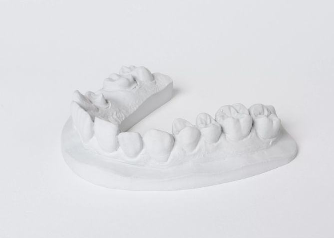Stone dental material - esthetic-rock® 285 - Dentona AG - modeling