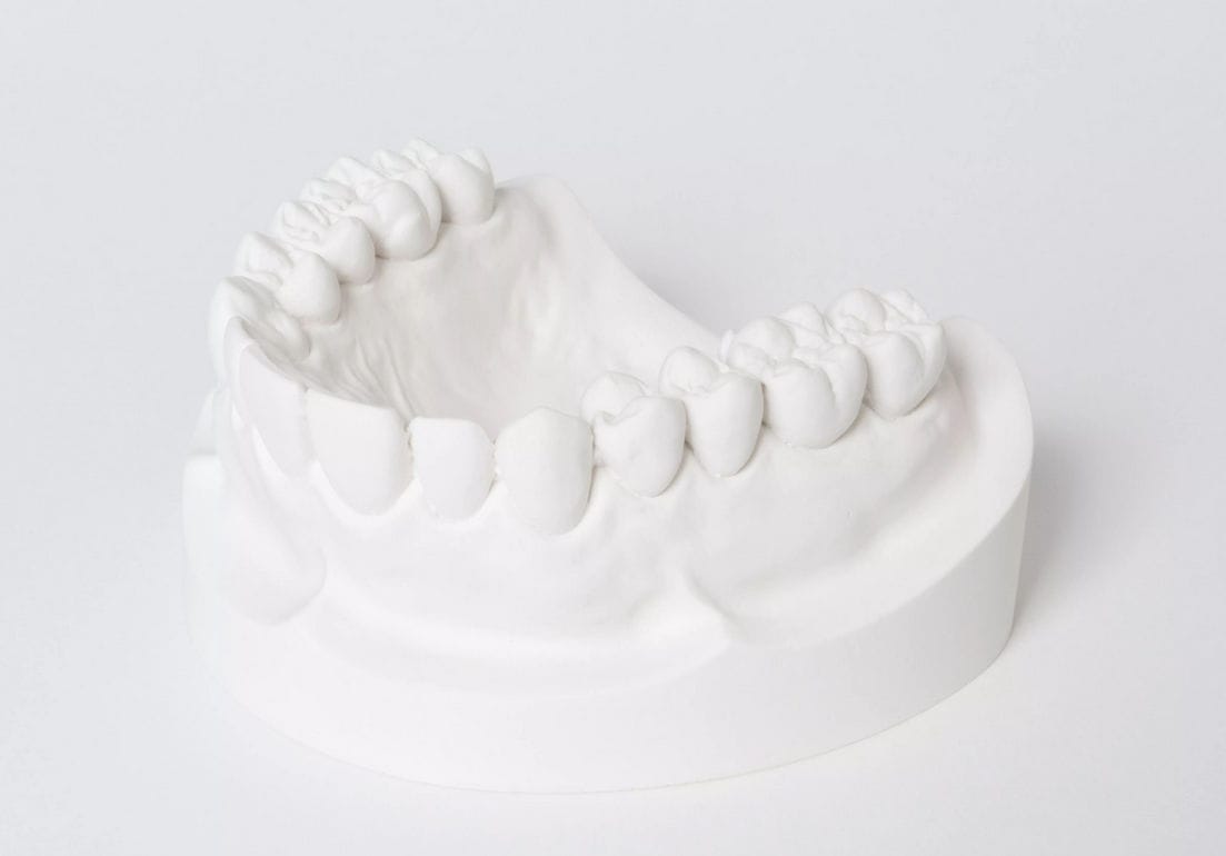 Plaster dental material - dento-stone® 220 - Dentona AG - casting / for ...