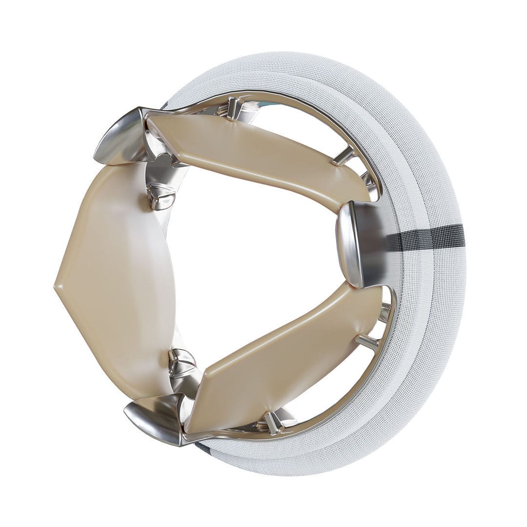 Aortic valve prosthesis - TRIFLO - MPS Precimed - titanium